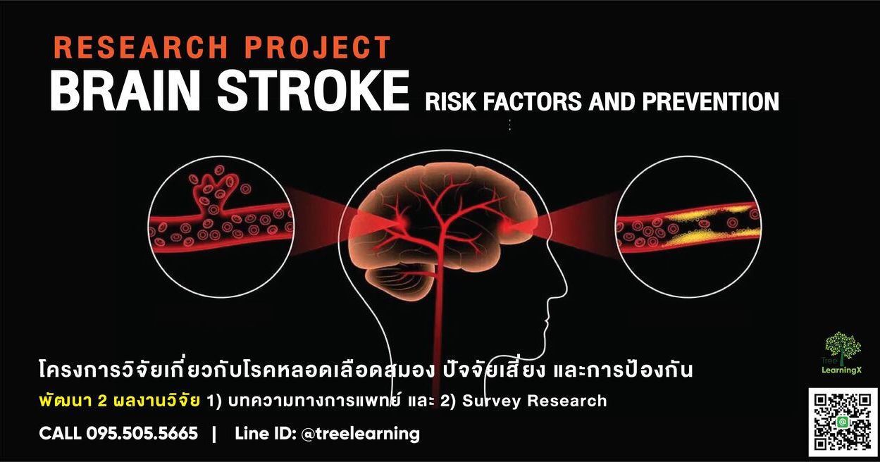 Research Project in Brain Stroke Sat4Feb23
