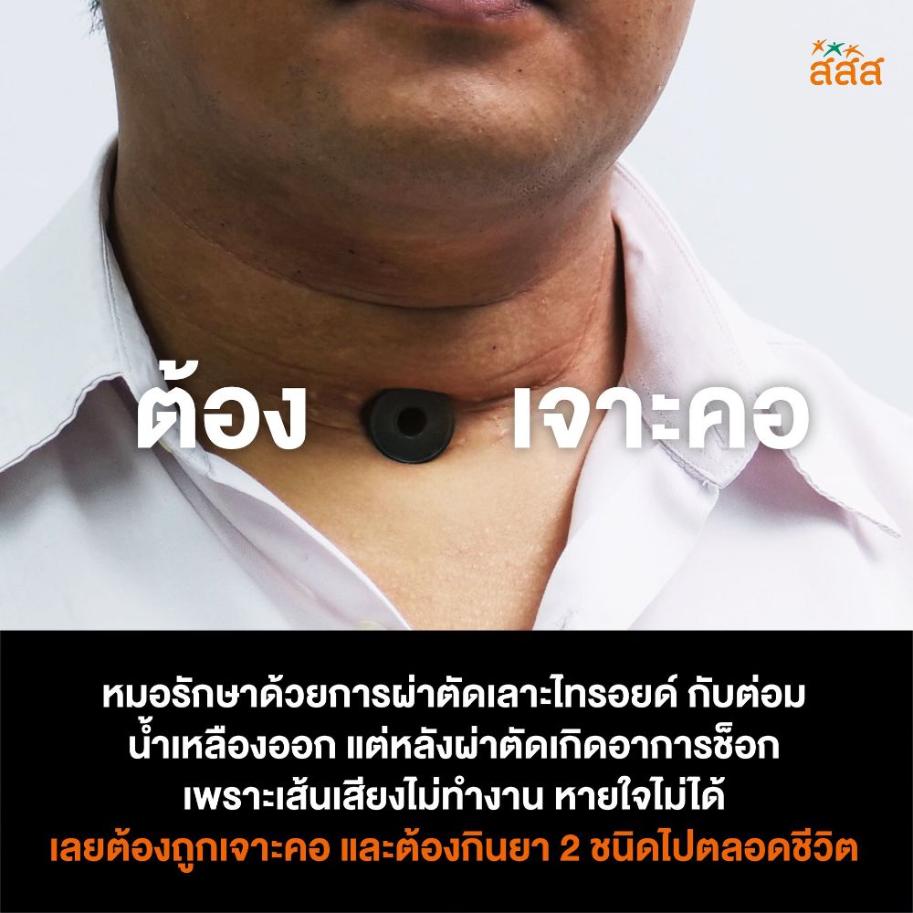 อายุแค่ 20 ถูกเจาะคอ