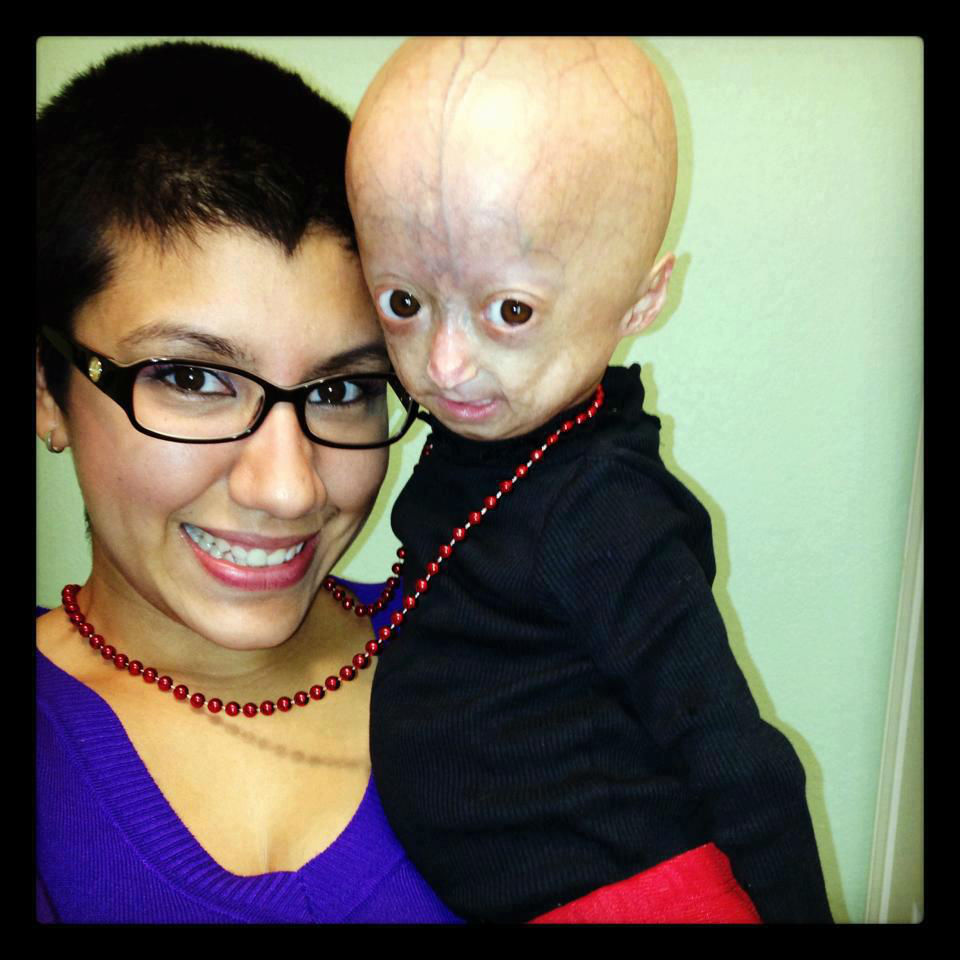 Adalia Rose ผู้หญิงที่มีคนติตามในเฟสบุ๊คเกือบ 10 ล้านคน!!!! | Dek-D.com