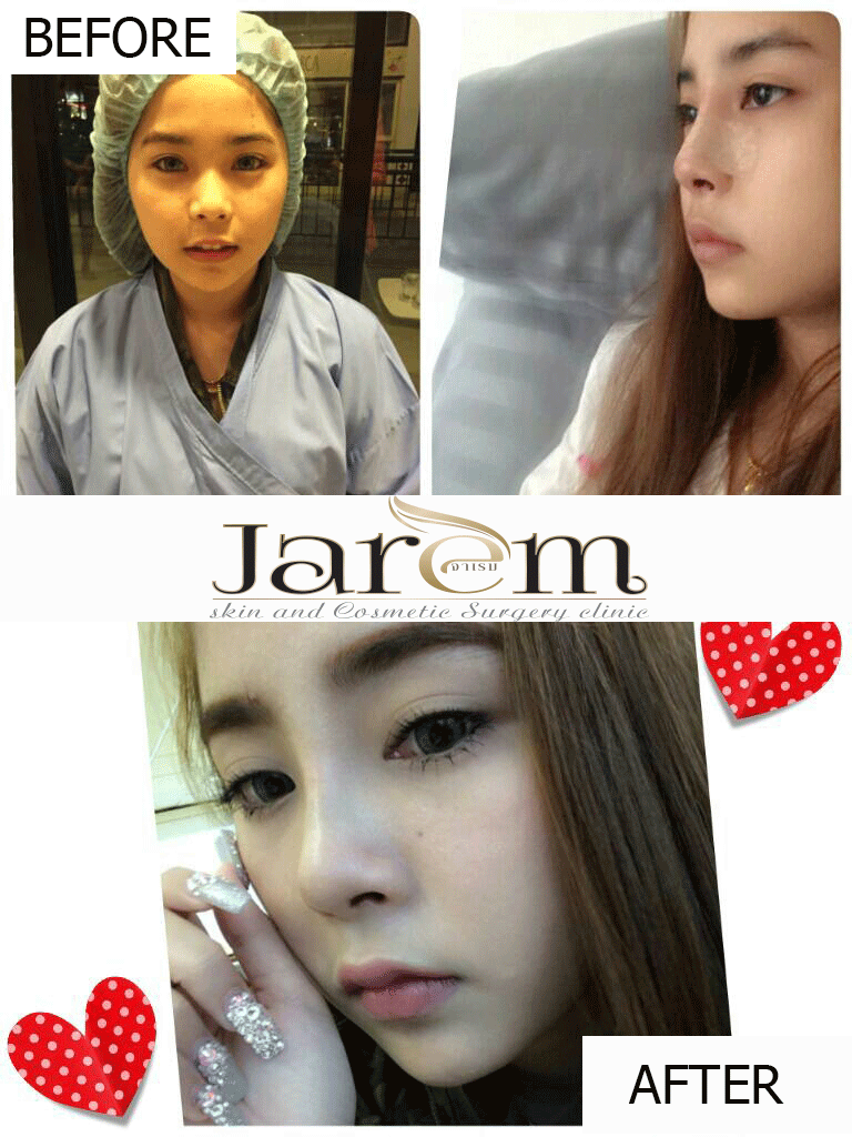 จมูกนี้ได้มาจาก #Jaremclinic | Dek-D.com